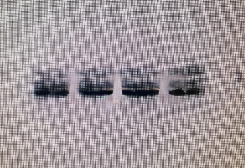 What causes the non specific bands in Western Blot elution buffer? - Ucallm