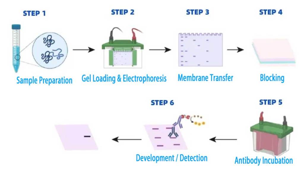 Western Blot Protocol: Step-by-Step Guide from Sample Prep to Detection ...