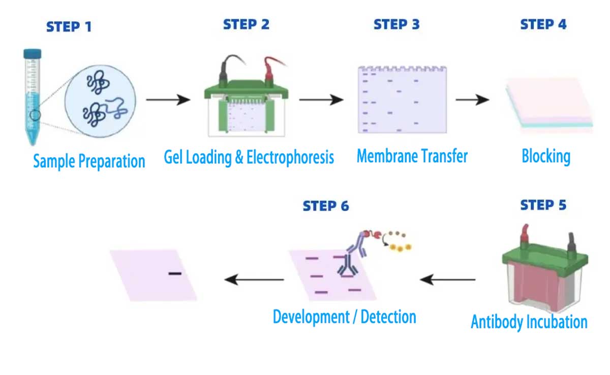 Western Blot Protocol: Step-by-Step Guide from Sample Prep to Detection – Ucallm