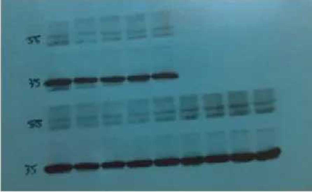 Why Is There No Signal in Western Blot? 5 Common Causes and Fixes – Ucallm