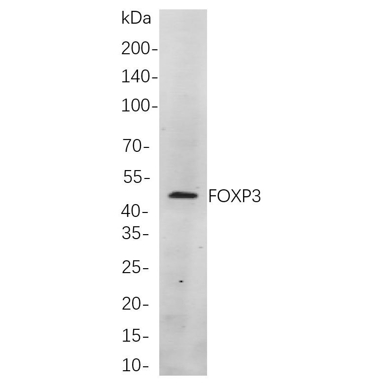 FOXP3 Rabbit mAb [PT0211R] - Ucallm