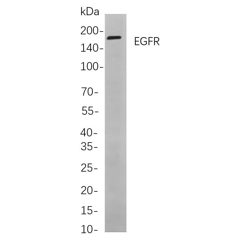 U-Blot® EGFR Rabbit mAb - Ucallm