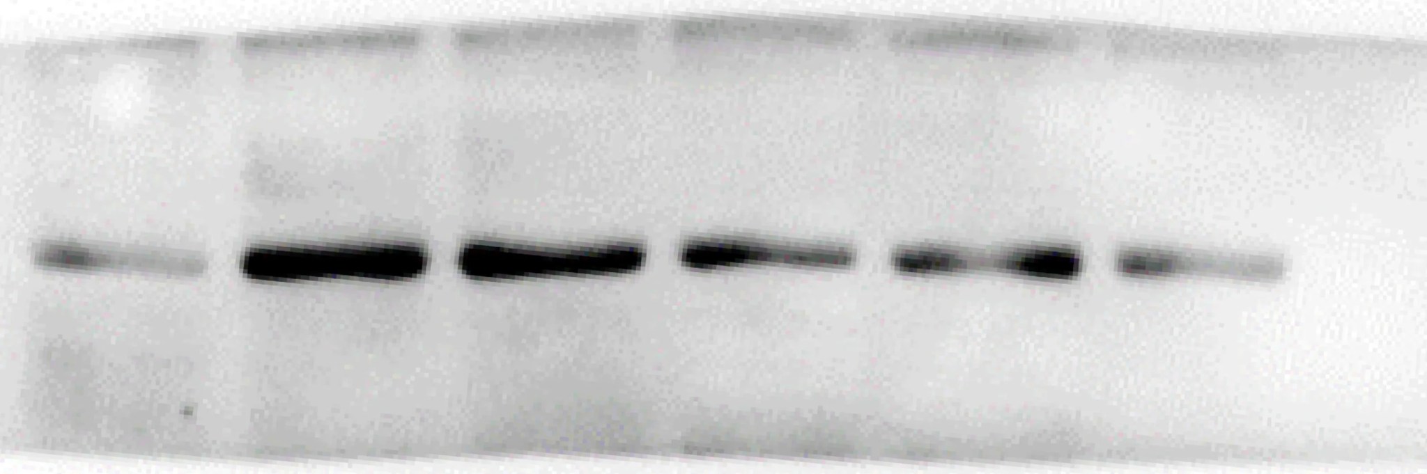 Western Blot Detection of Phosphorylated Proteins - Ucallm